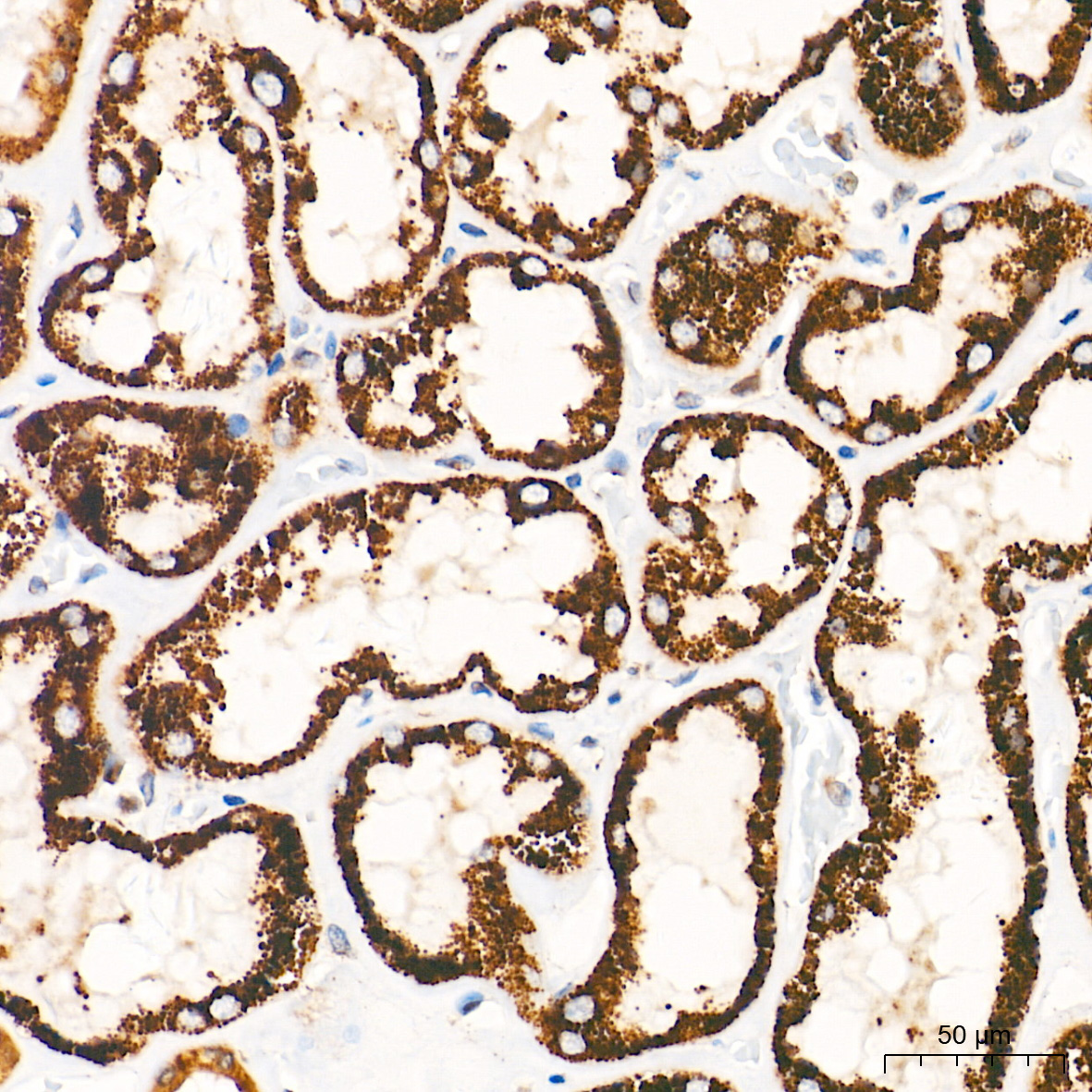 GM130 Rabbit mAb-Monoclonal Antibodies - ABclonal/拜爾國際(BioAb)