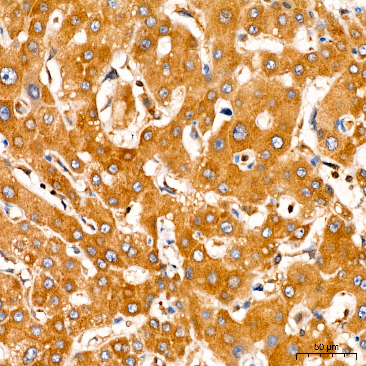 ATP7B Rabbit pAb-Polyclonal Antibodies - ABclonal/拜爾國際(BioAb)